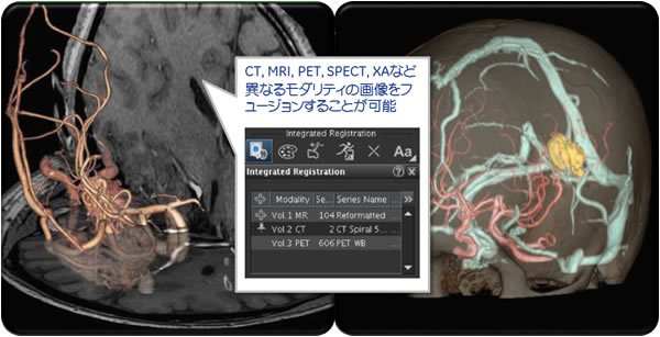 Centricity Universal Viewer | GE Healthcare (Japan)