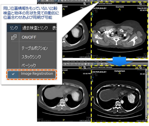 Centricity Universal Viewer | GE Healthcare (Japan)