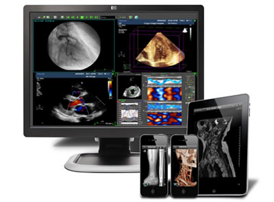 Centricity Universal Viewer | GE Healthcare (Japan)