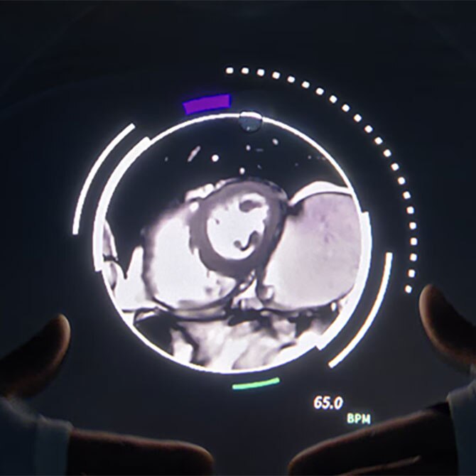 Sonic Dl™によるライフスピードイメージング： ディープラーニングMRI加速 | GE HealthCare (Japan)