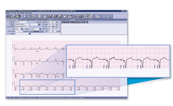 MUSE心臓病情報システムのECG