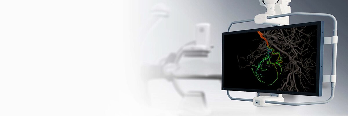 Embo ASSIST | GE Healthcare (Japan)