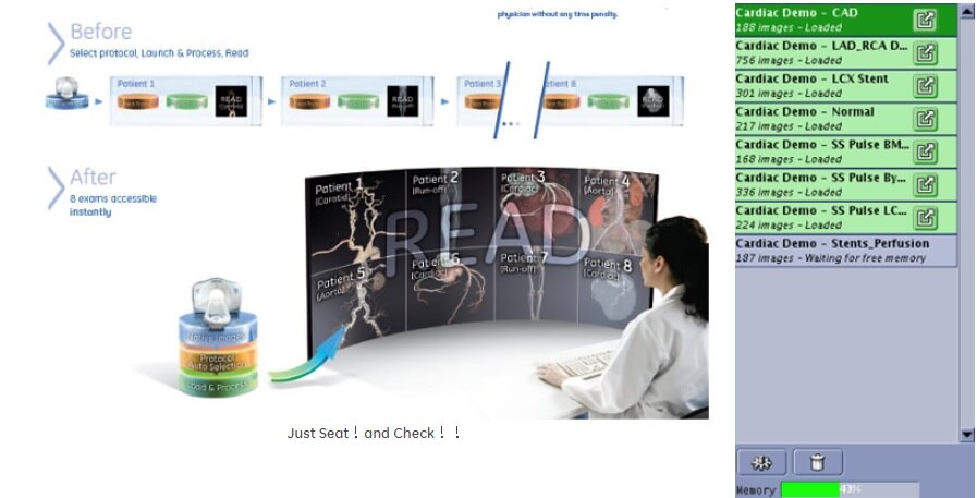 Advanced Visualization | GE Healthcare (Japan)