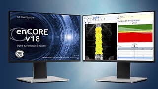 enCORE Software Platform | GE HealthCare (Japan)