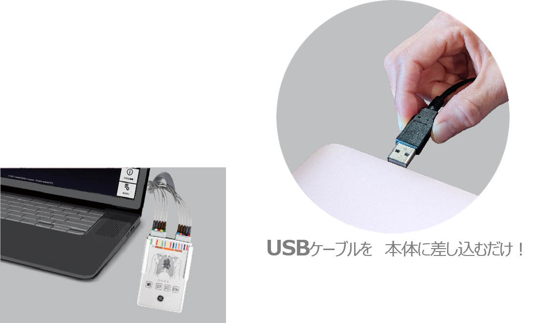 CardioSoft ECG 多機能ネットワーク型自動解析心電計 | GE Healthcare (Japan)