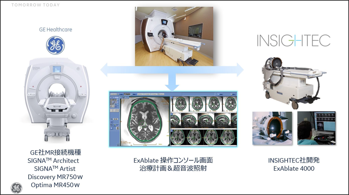 ExAblate4000 | GE Healthcare (Japan)