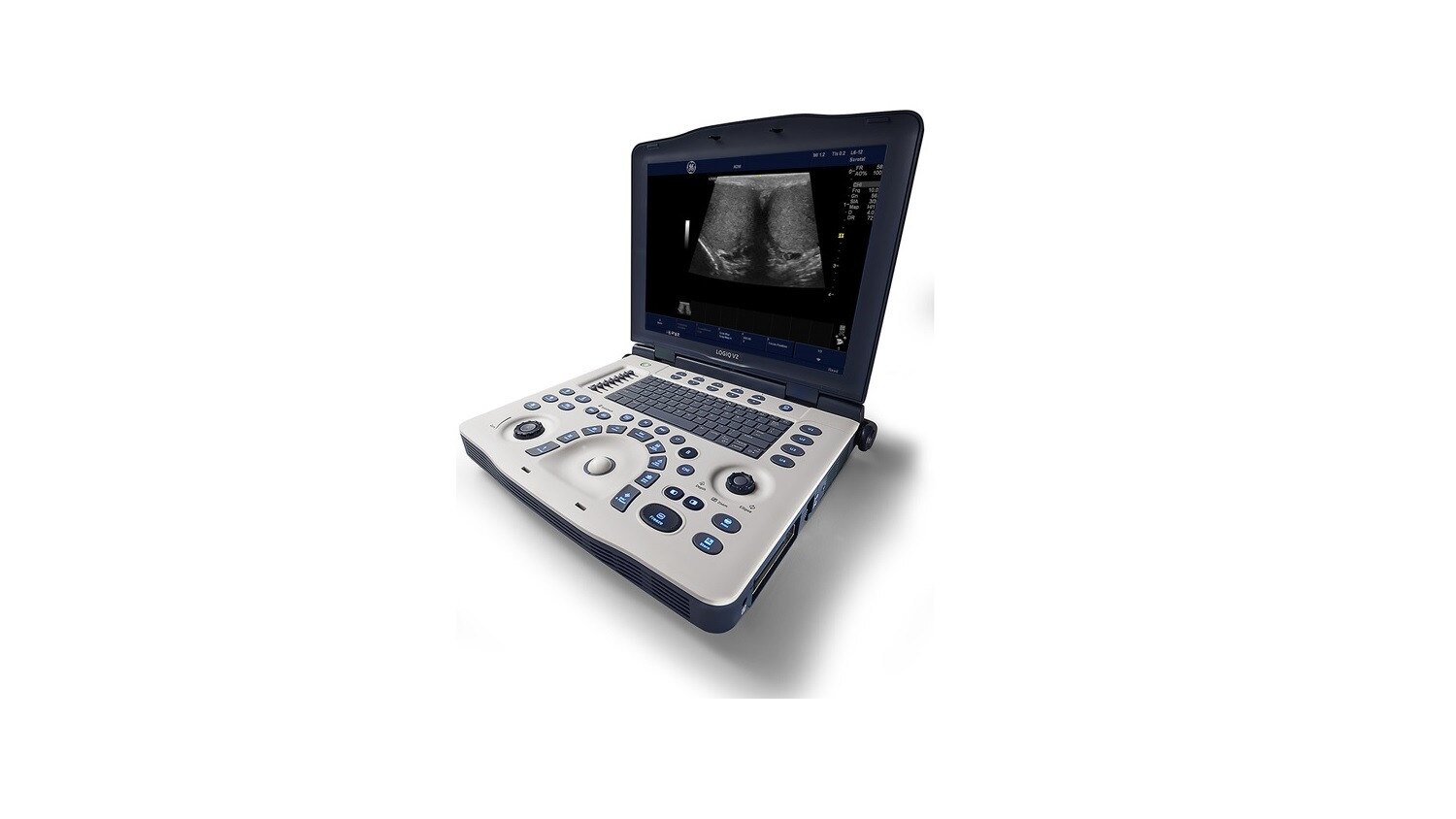 LOGIQ V2 | GE HealthCare (Japan)