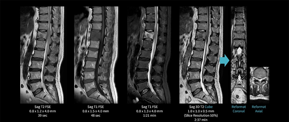 MR30によって実感したMRI検査の「新時代」の到来 | GE HealthCare (Japan)