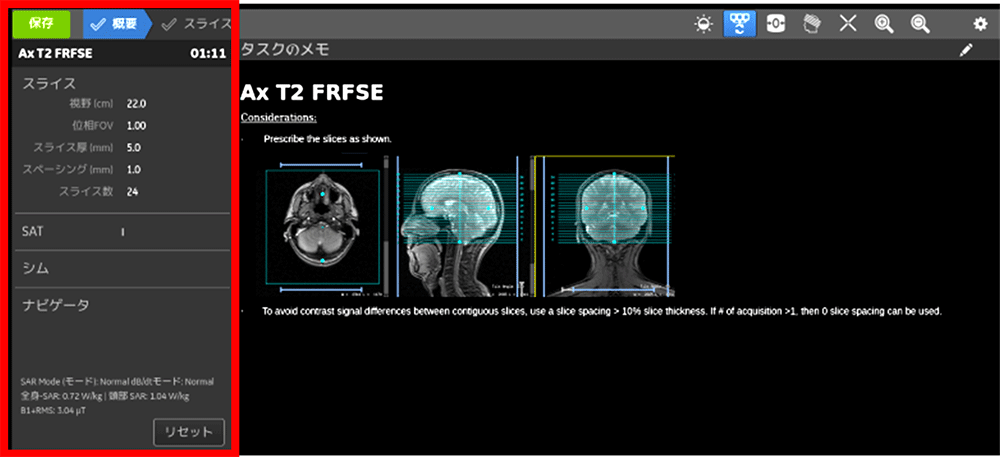 新型ユーザーインターフェイス「SIGNA™ One」を搭載したSIGNA™ Primeの使用経験 | GE HealthCare (Japan)