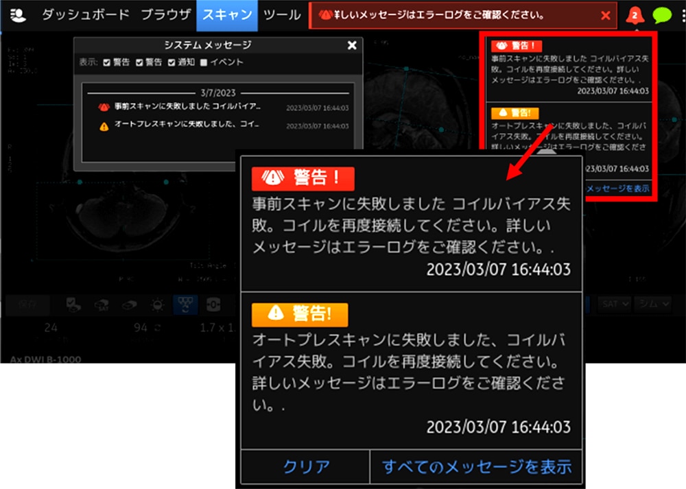 新型ユーザーインターフェイス「SIGNA™ One」を搭載したSIGNA™ Primeの使用経験 | GE HealthCare (Japan)