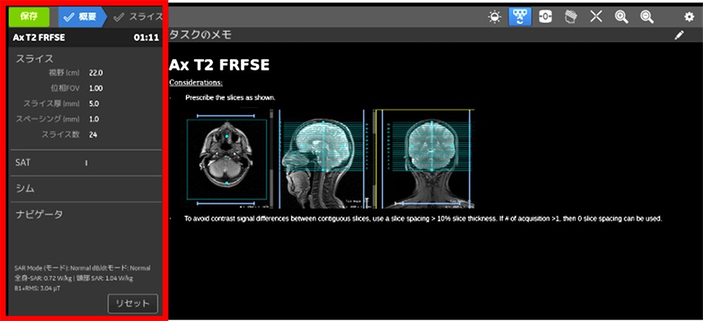 新型ユーザーインターフェイス「SIGNA™ One」を搭載したSIGNA™ Primeの使用経験 | GE HealthCare (Japan)