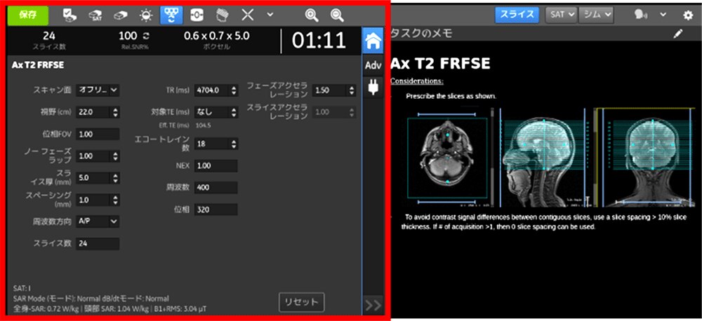 新型ユーザーインターフェイス「SIGNA™ One」を搭載したSIGNA™ Primeの使用経験 | GE HealthCare (Japan)